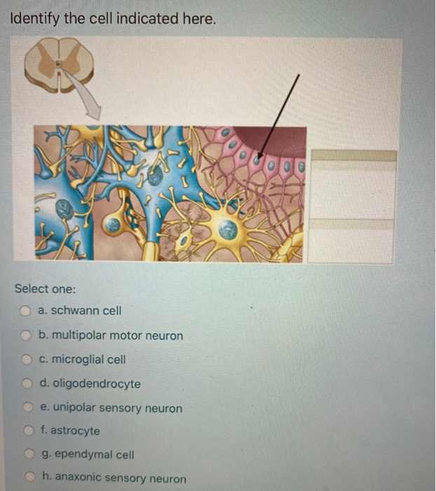 Solved Which of the following layers represents the fibrous | Chegg.com