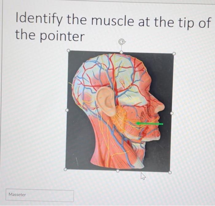 Solved Identify the muscle at the tip of the | Chegg.com