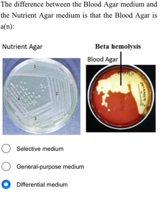 Solved What is achieved by flaming the inoculating | Chegg.com