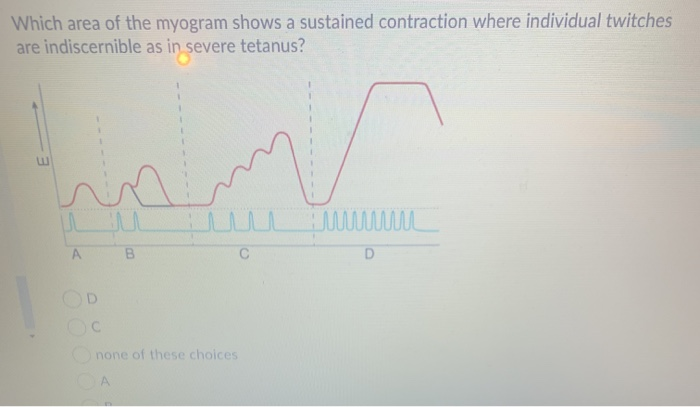 Solved Which area of the myogram shows a sustained | Chegg.com