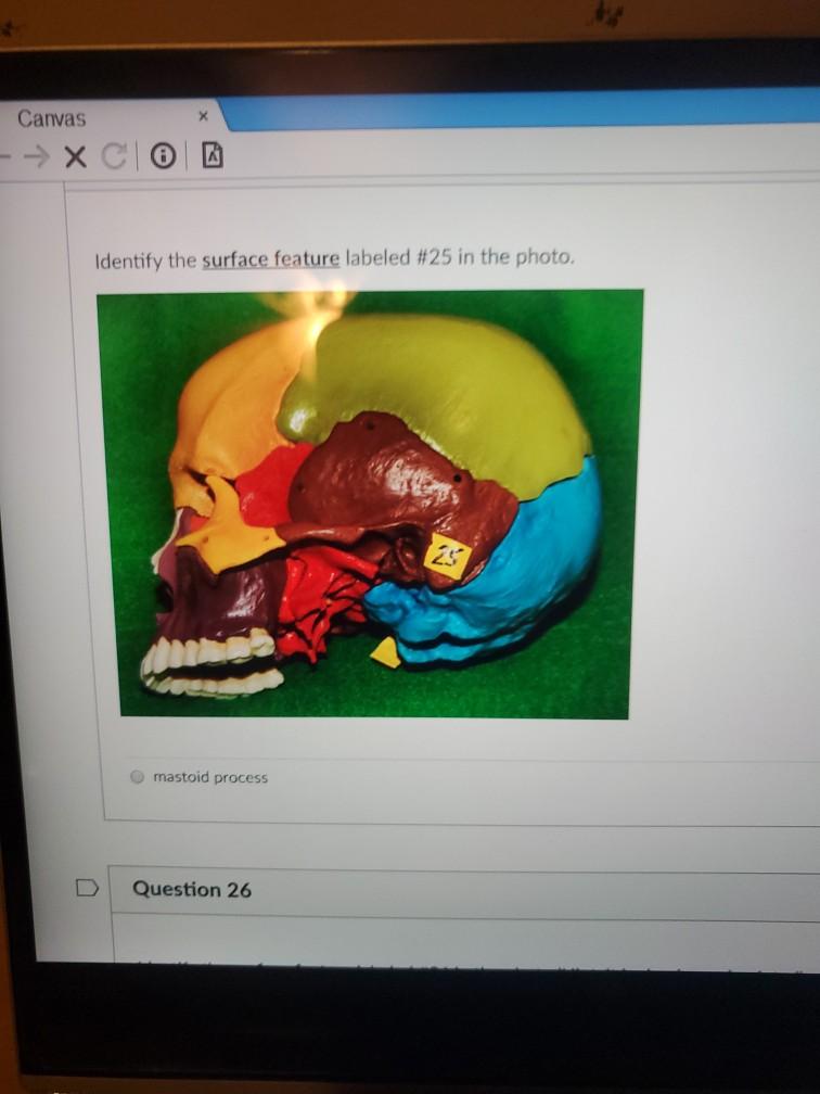 Solved Canvas .-X Clo Identify the surface feature labeled | Chegg.com