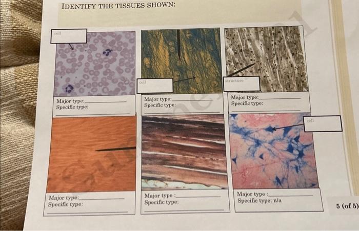 IDENTIFY THE TISSUES SHOWN:IDENTIFY THE TISSUES | Chegg.com IDENTIFY THE TISSUES SHOWN:IDENTIFY THE TISSUES | Chegg.com
