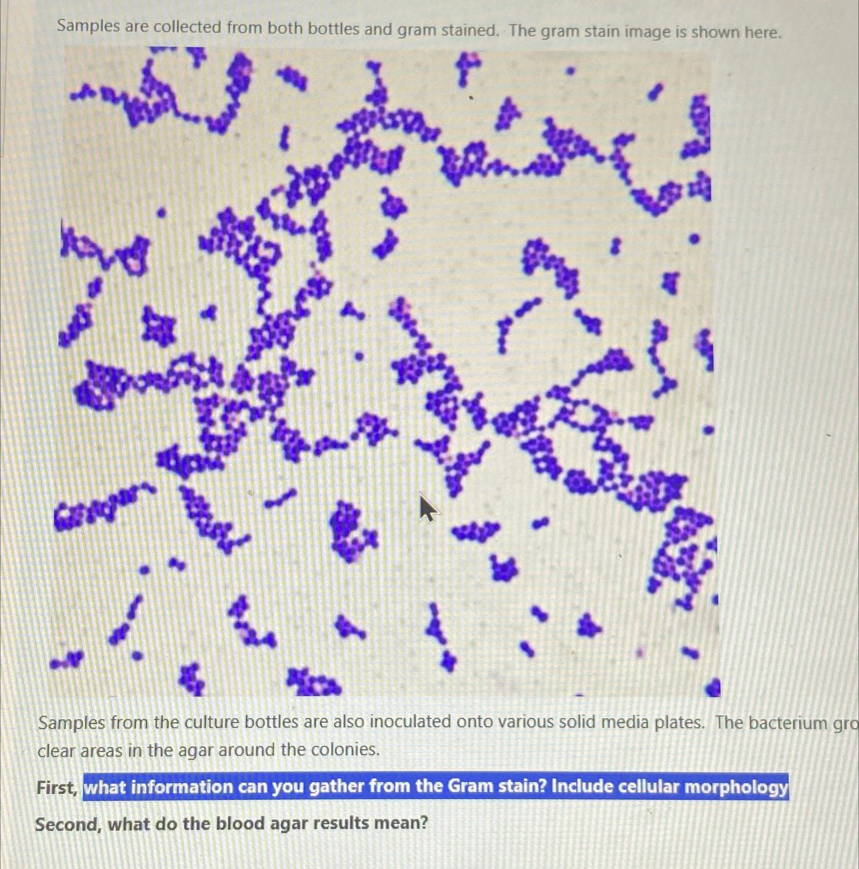 Solved Samples are collected from both bottles and gram | Chegg.com