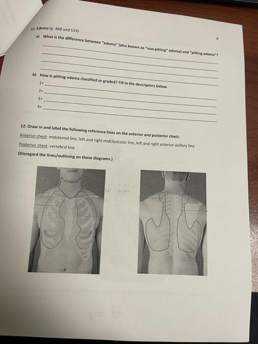 Solved 11. Edema (p. 468 and 519 ) a) What is the difference | Chegg.com