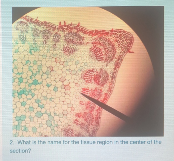 Solved 2. What is the name for the tissue region in the | Chegg.com