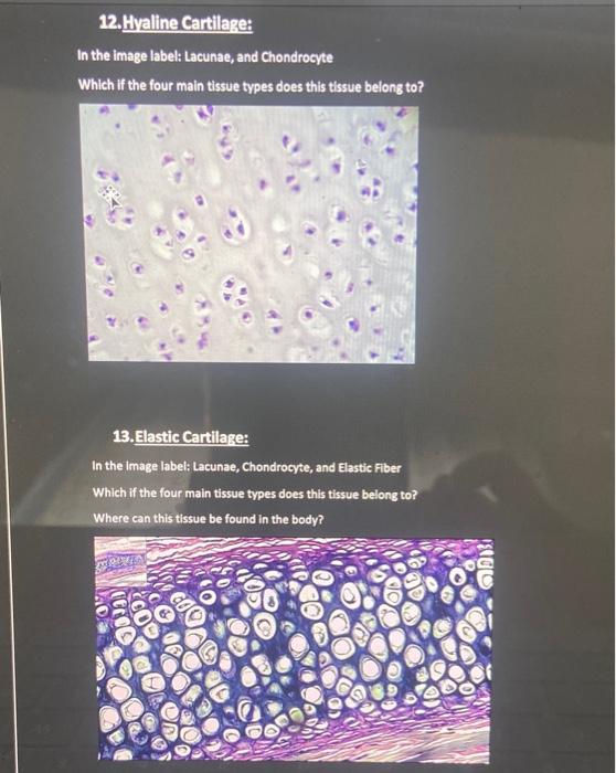 Solved 12. Hyaline Cartilage: In the image label: Lacunae, | Chegg.com