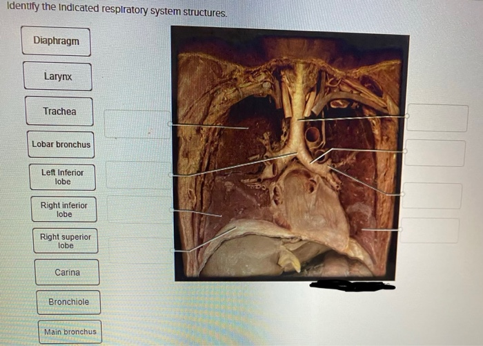 Solved Identify the Indicated respiratory system structures. | Chegg.com