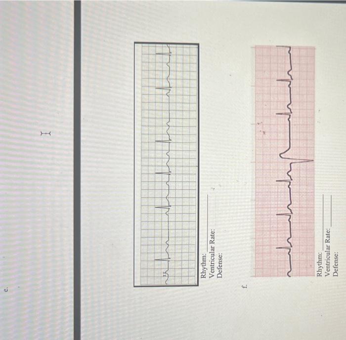 Solved 8. Identify the following rhythms and provide a | Chegg.com