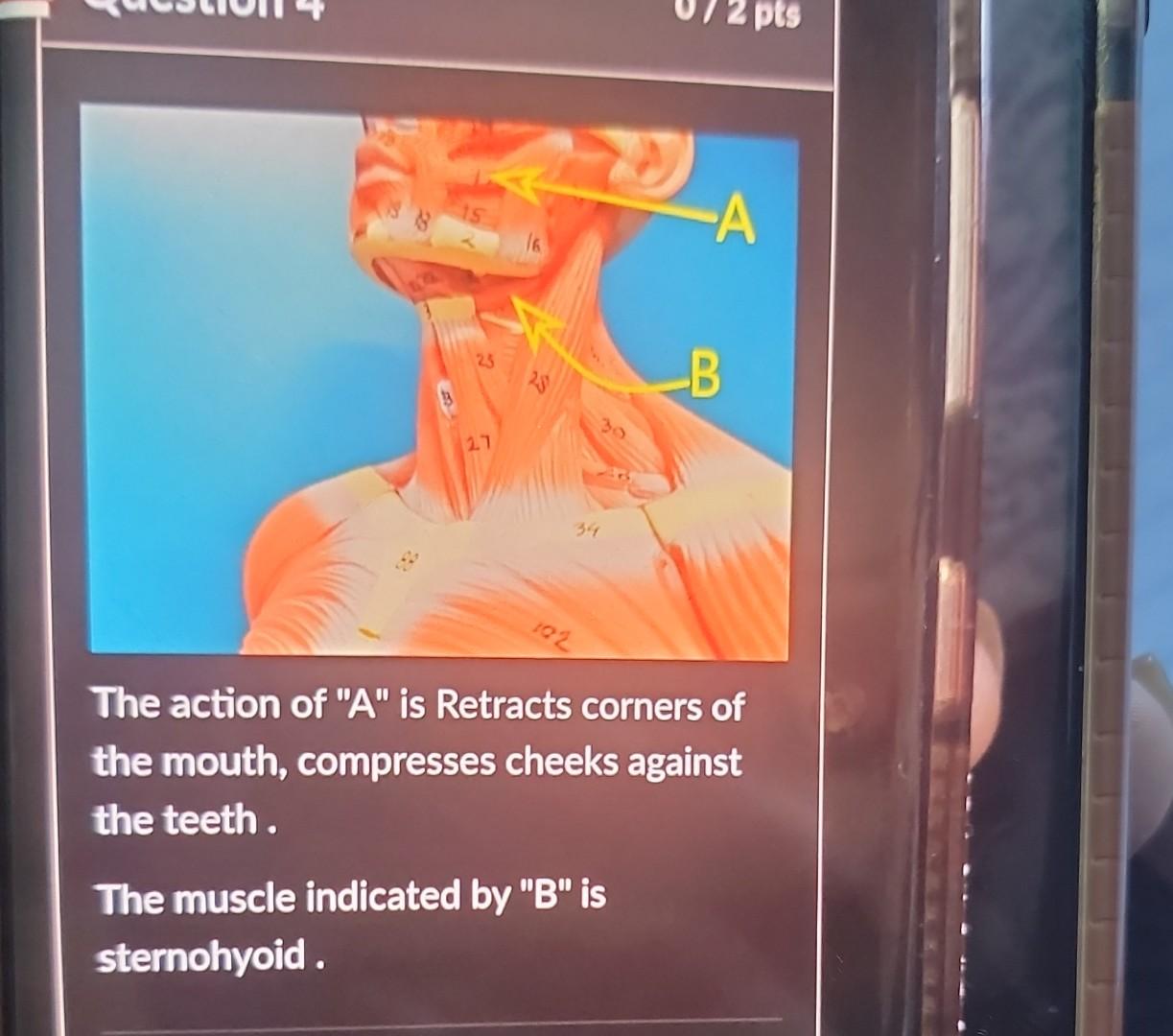 Solved 23 27 28 34 102 The muscle indicated by "B" is | Chegg.com