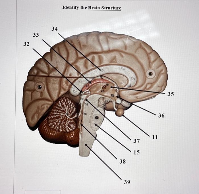 Solved Identify the Brain Structure | Chegg.com