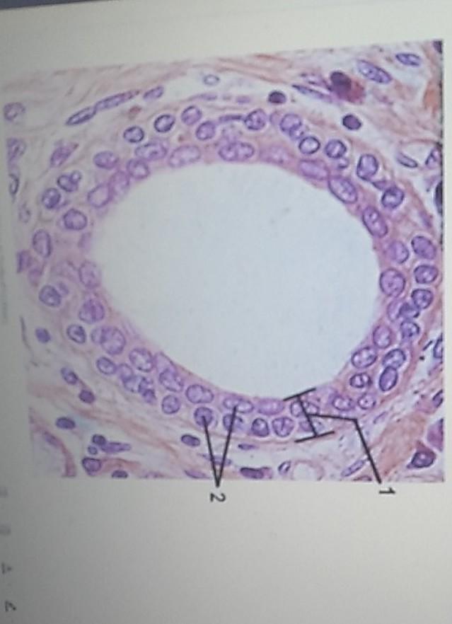 Solved What type of epithelial is indicated by tag #1? What | Chegg.com