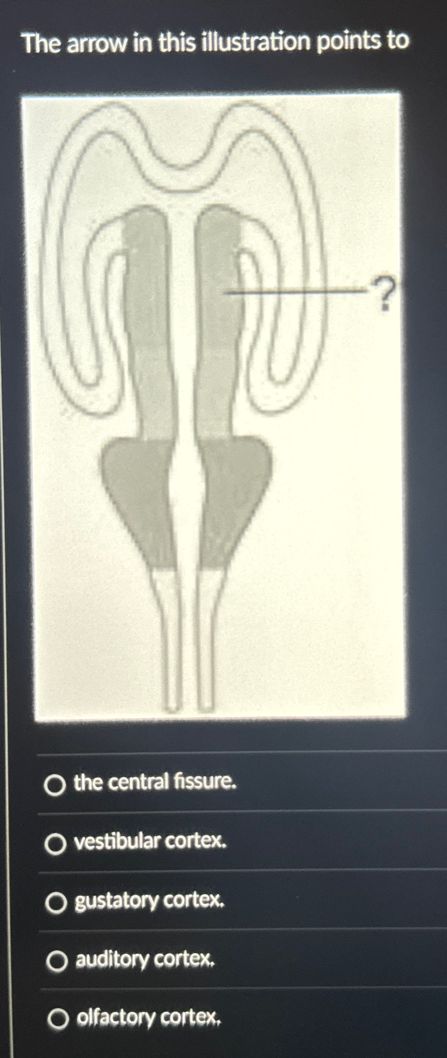 Solved The arrow in this illustration points tothe central | Chegg.com