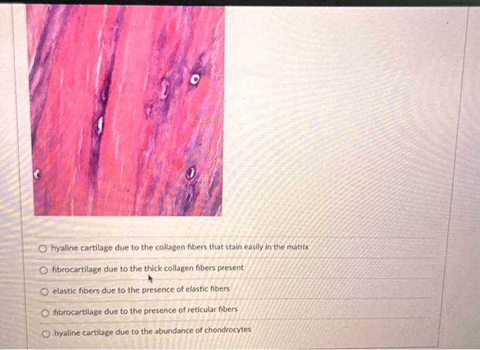 hyaline cartilage due to the collagen fibers that | Chegg.com