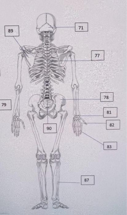 Solved label please | Chegg.com