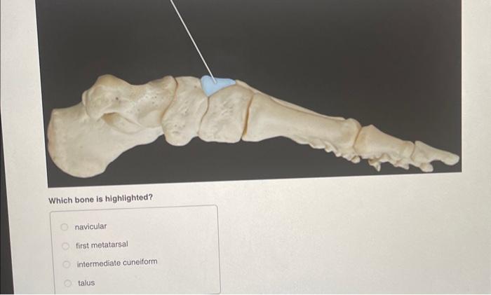 Solved Which bone is highlighted? navicular first metatarsal | Chegg.com
