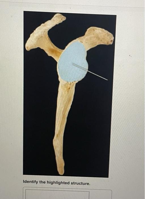 Solved Part A > Identify the highlighted structure. | Chegg.com