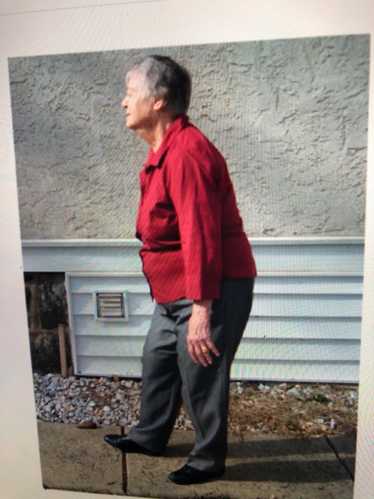 Solved 1. Postural Variation • Describe some of the changes | Chegg.com