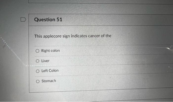 Solved This applecore sign indicates cancer of the Right | Chegg.com