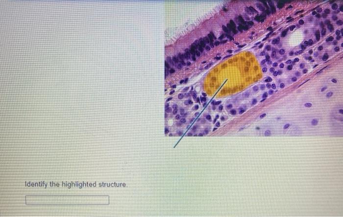 Solved Identify the highlighted structure. | Chegg.com