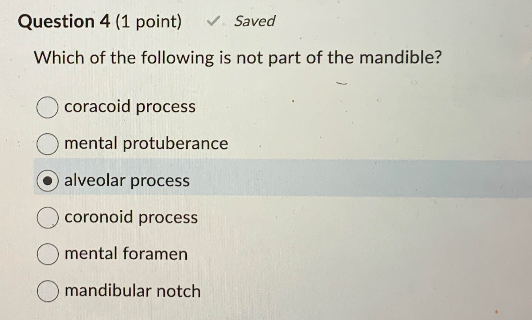 Solved Question 4 (1 ﻿point) ﻿SavedWhich of the following | Chegg.com