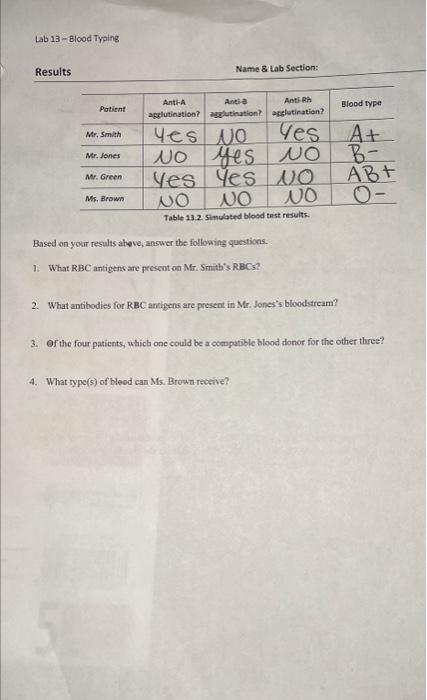 Solved Lab 13 - Blood Typing Results Name & Lab Section: | Chegg.com
