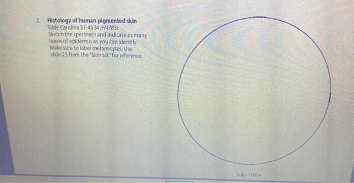 Solved 2 Histology of human pigmented skin Slide Carolina | Chegg.com