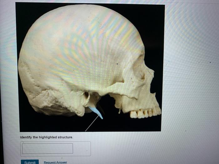 Solved Part A Identify the highlighted bones. Identify the | Chegg.com