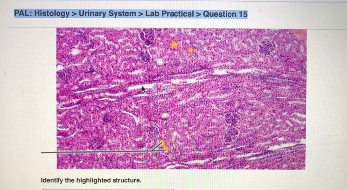 Solved PAL: Histology > Urinary System > Lab Practical > | Chegg.com