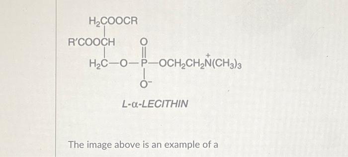Solved H₂COOCR R'COOCH H₂C-O-P-OCH₂CH₂N(CH3)3 O™ | Chegg.com
