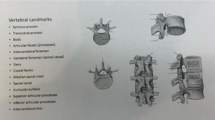 Solved Vertebral Landmarks • Spinous process • Transverse | Chegg.com