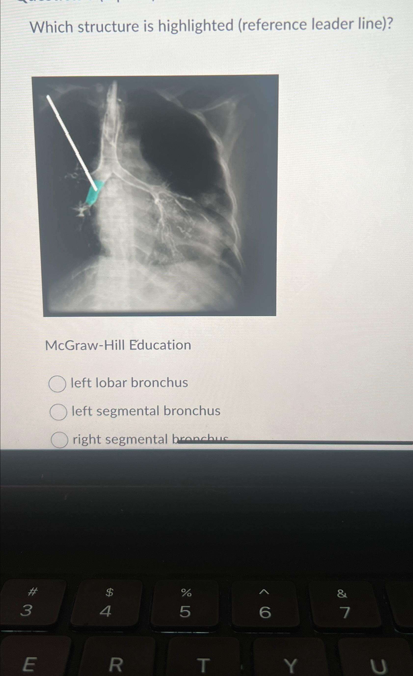 Solved Which structure is highlighted (reference leader | Chegg.com