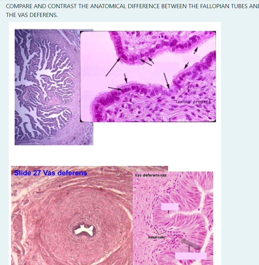Solved COMPARE AND CONTRAST THE ANATOMICAL DIFFERENCE | Chegg.com