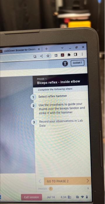 Solved PHASE 1: Blceps reflex - Inside elbow Complete the | Chegg.com