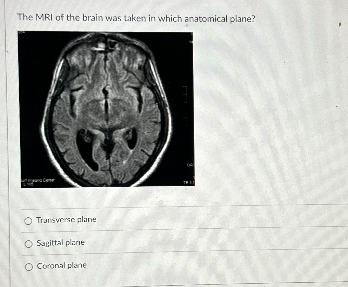 Solved The MRI of the brain was taken in which anatomical | Chegg.com