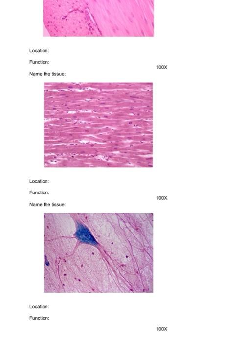 Solved 11. Identify nervous tissue and each of the three | Chegg.com