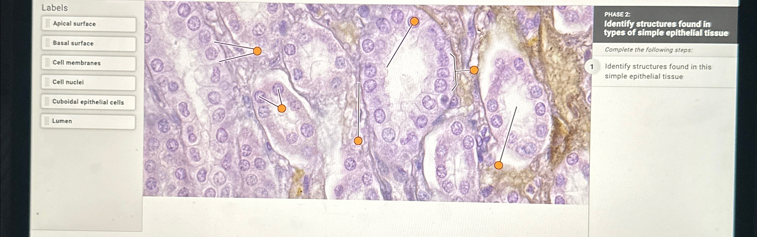 [Solved]: Labels Apical surface Basal surface Cell membranes