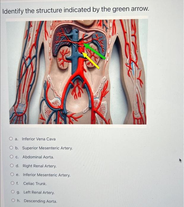 Solved Identify the structure indicated by the green arrow. | Chegg.com