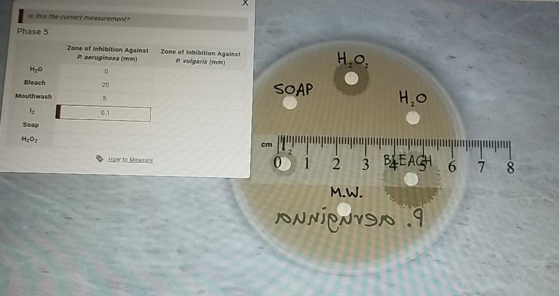 Solved Is this the correct measurement? Phase 5 Zone of | Chegg.com