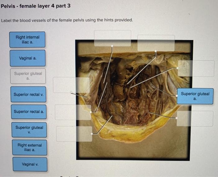 Solved Label the blood vessels of the female pelvis using | Chegg.com