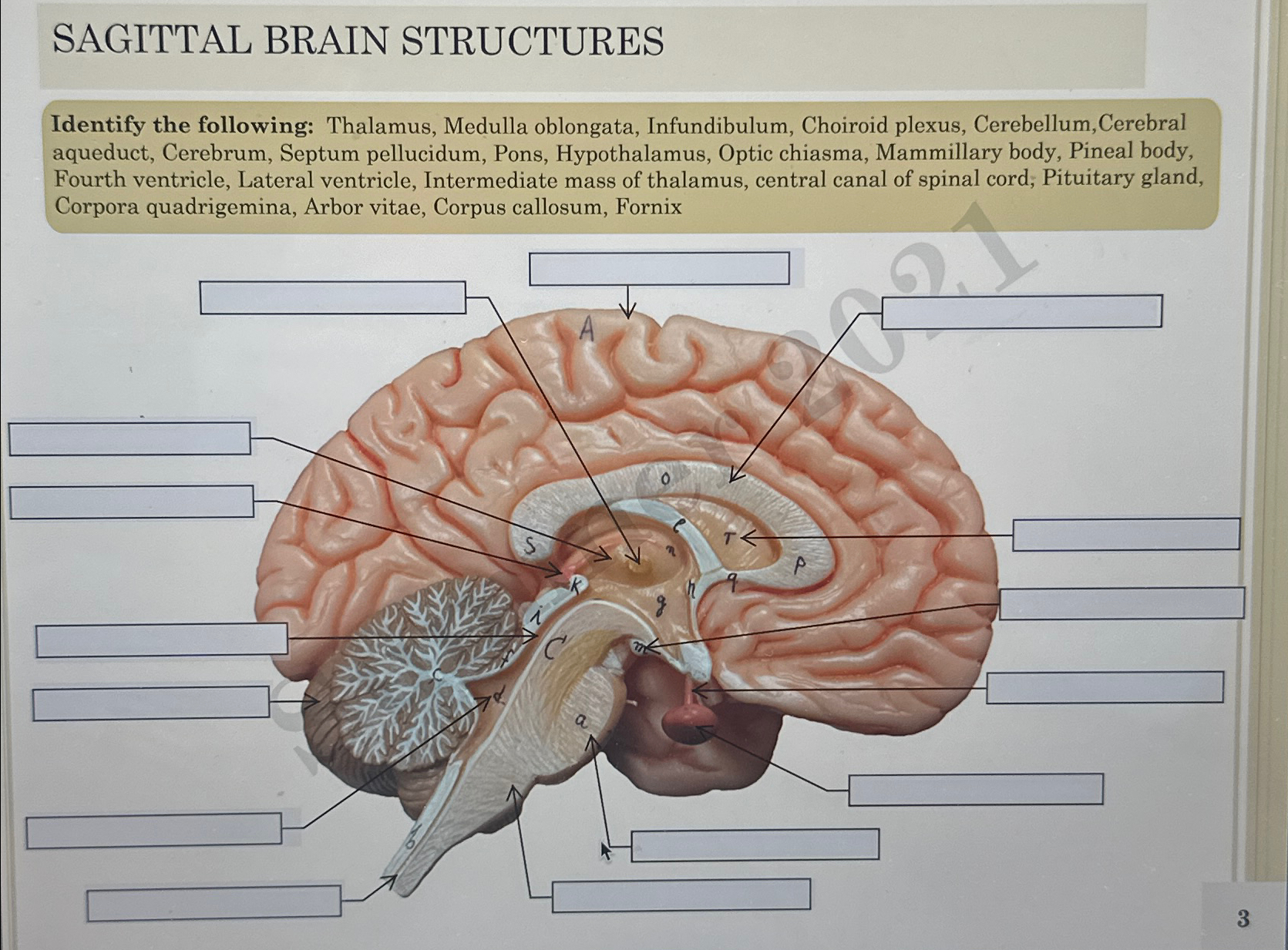 Solved SAGITTAL BRAIN STRUCTURESIdentify the following: | Chegg.com