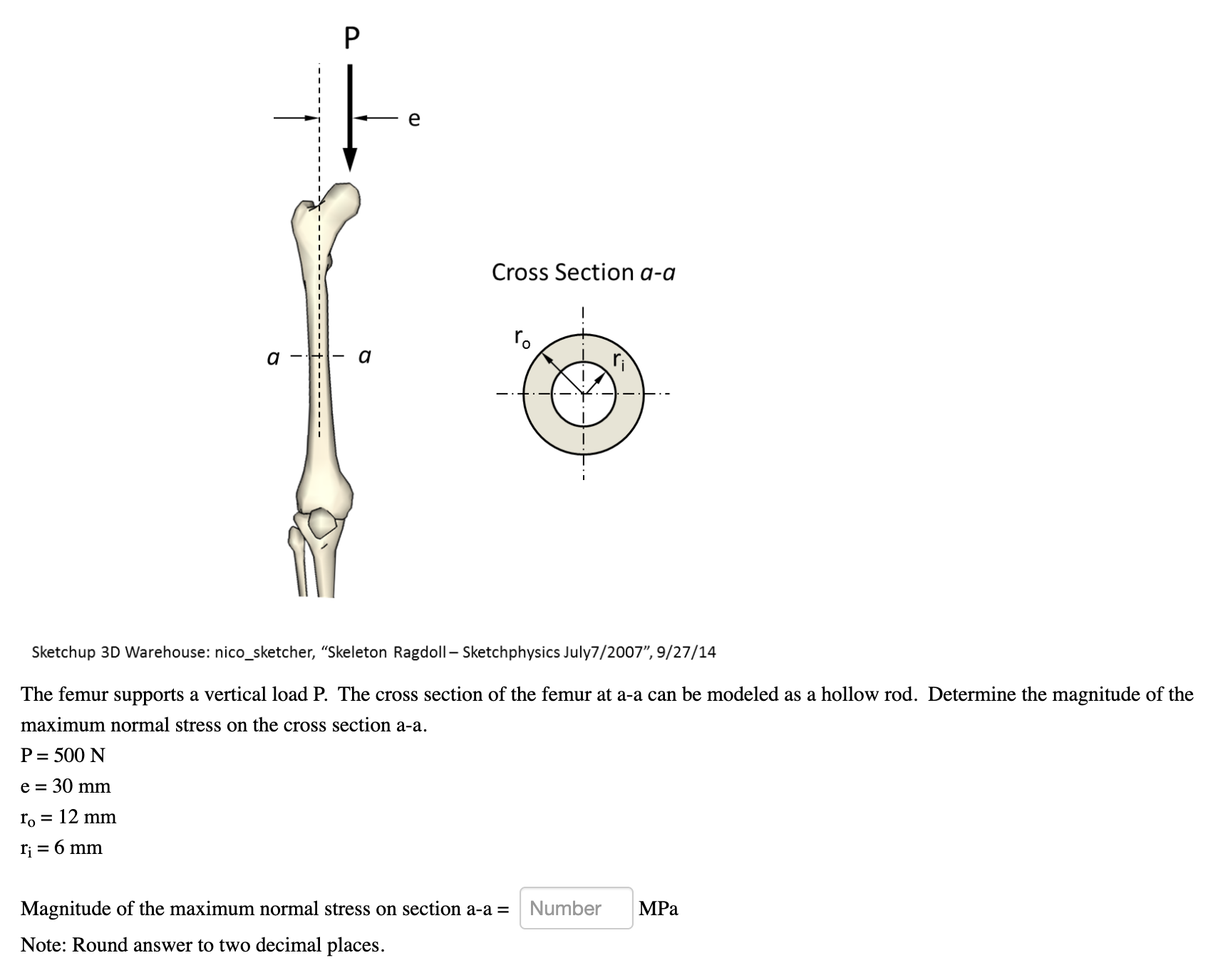 Solved The femur supports a vertical load P . ﻿The cross | Chegg.com