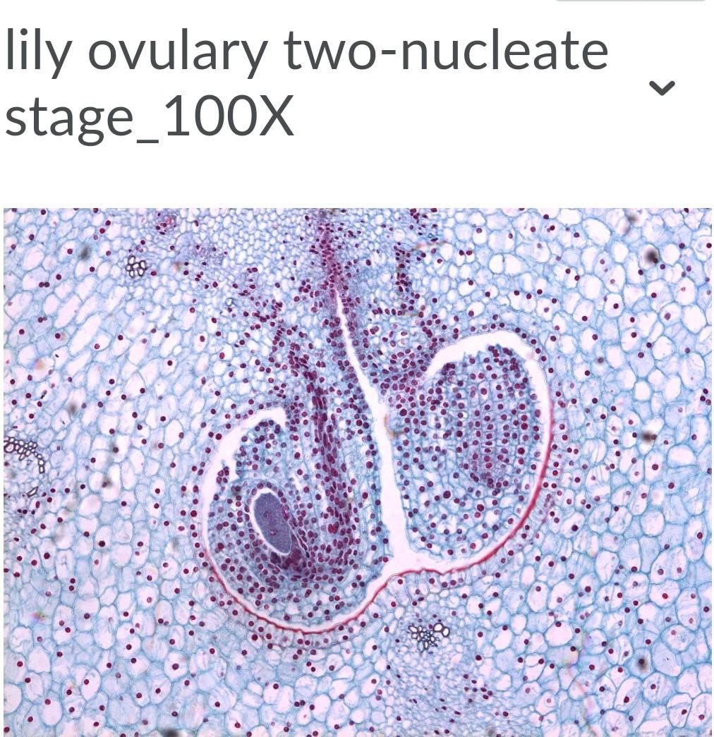 Solved lily ovulary four- nucleate stage_400X lily ovulary | Chegg.com