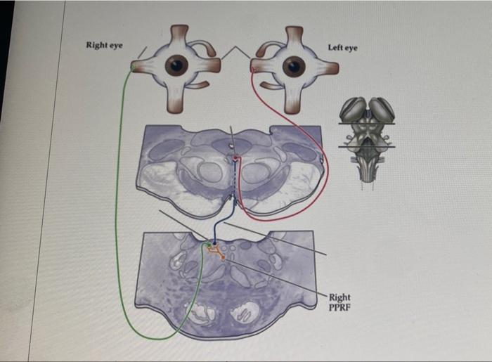 Solved Right eye Left eye Right PPRF Refer to the PPRF | Chegg.com