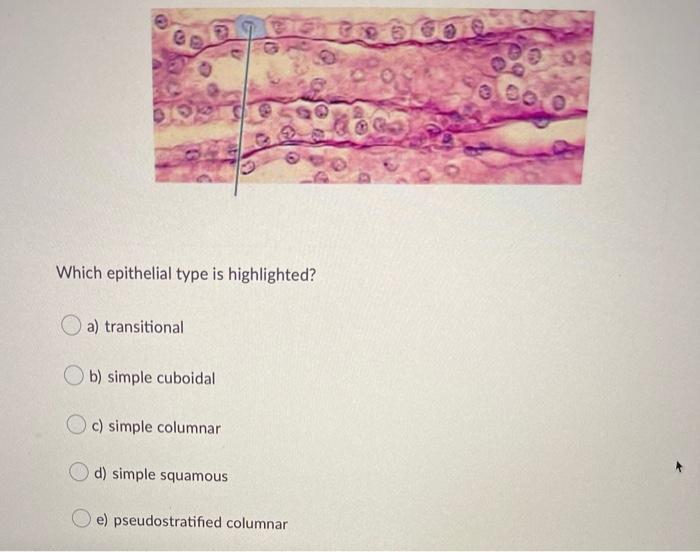 Solved Which epithelial type is highlighted? a) transitional | Chegg.com