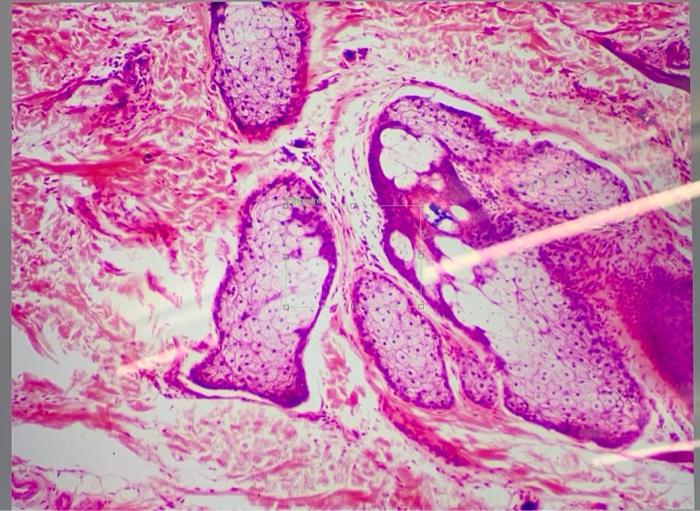 Solved 3. Label each image, pointing to - Type(s) of | Chegg.com