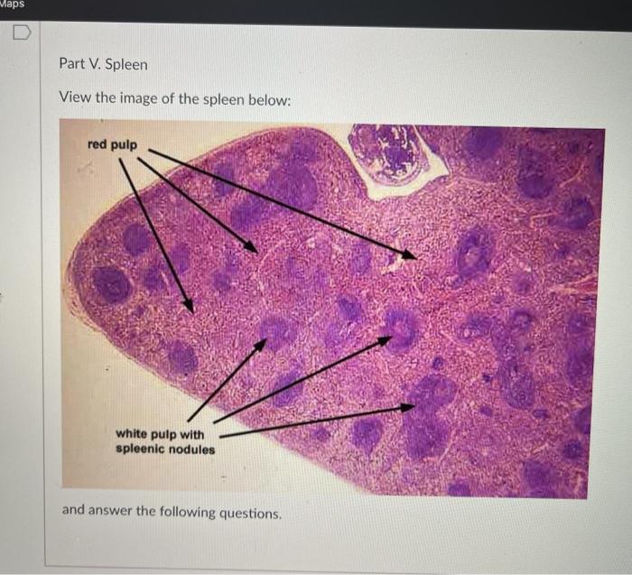 Solved Maps Part V. Spleen View the image of the spleen | Chegg.com