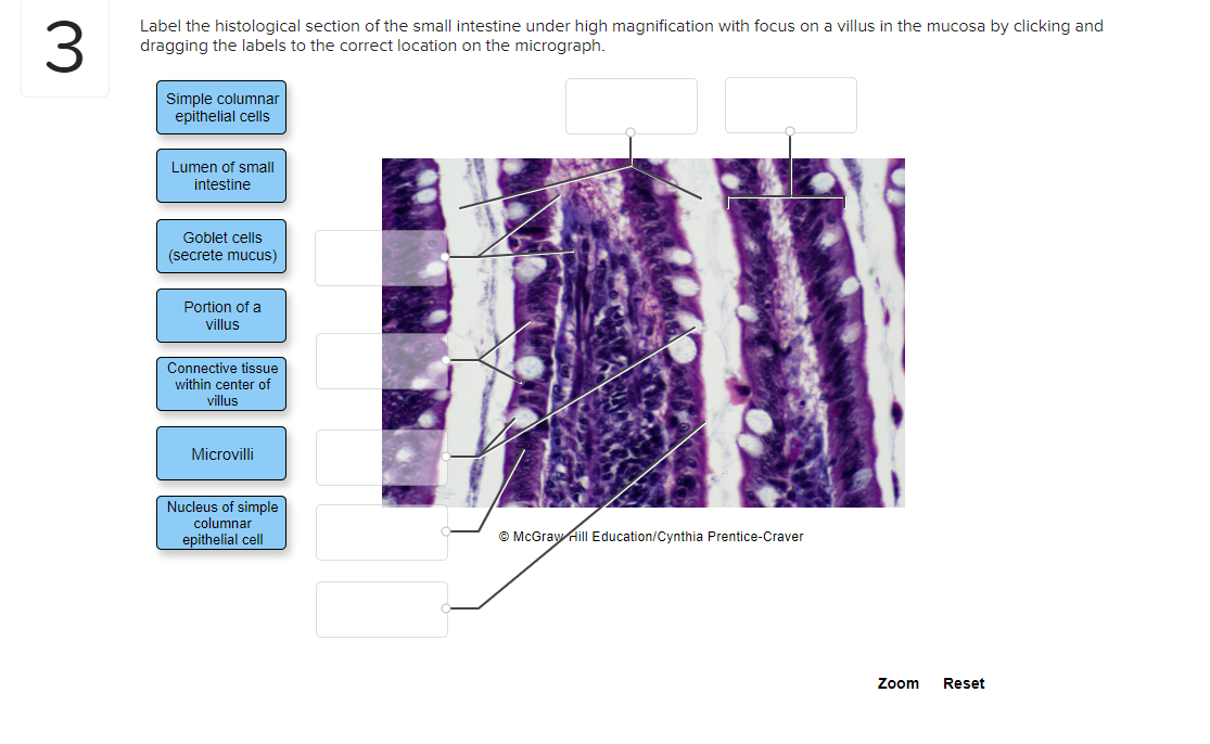 Solved 3Label the histological section of the small | Chegg.com