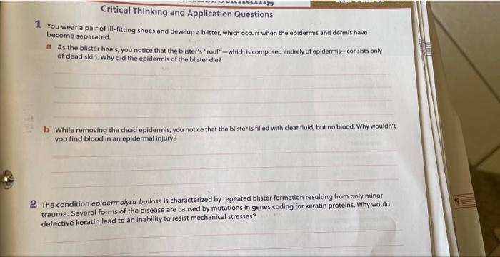 Solved 1 You wear a pair of ill-fitting shoes and develop a | Chegg.com