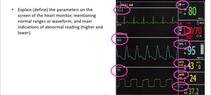 Solved - Explain (define) the parameters on the screen of | Chegg.com