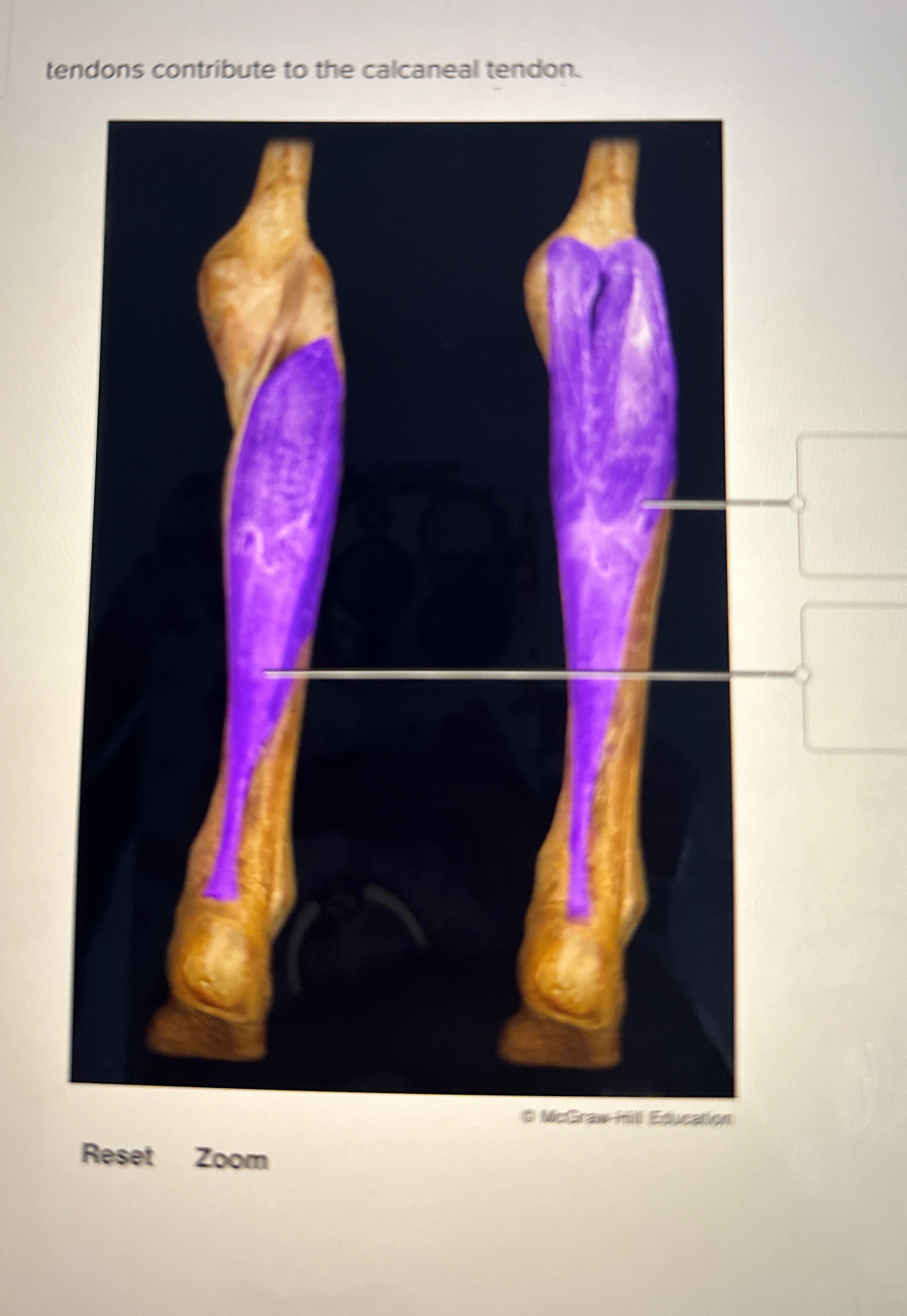 Solved tendons contribute to the calcaneal tendon.Q Micceraw | Chegg.com Solved tendons contribute to the calcaneal tendon.Q Micceraw | Chegg.com